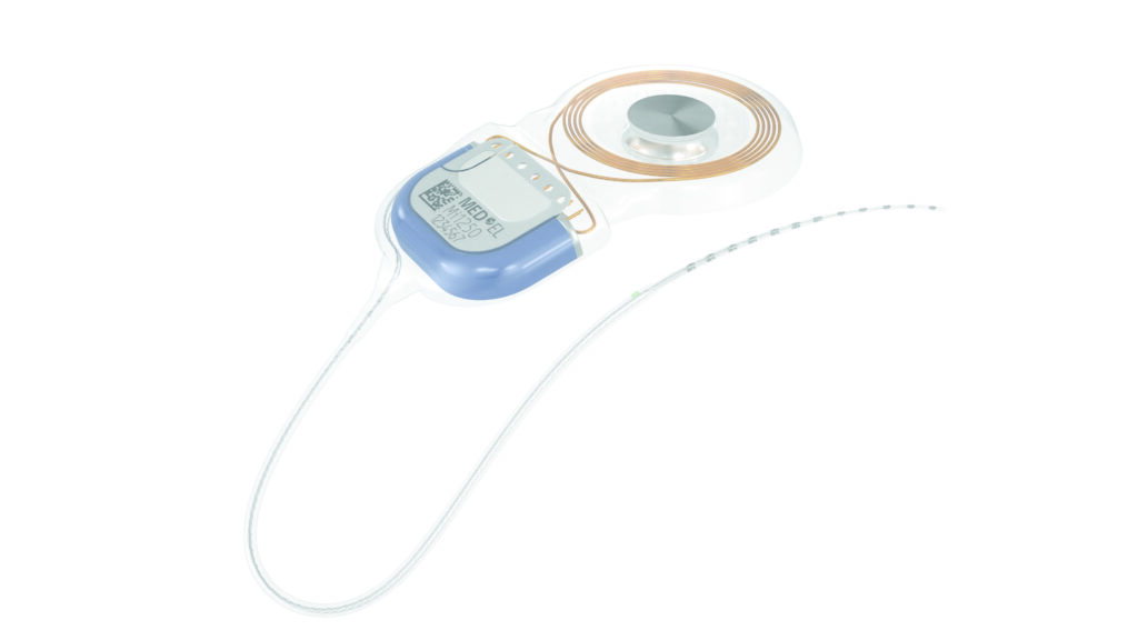 MED-EL– The Hearing Implant Company - National Cochlear Implant Users ...